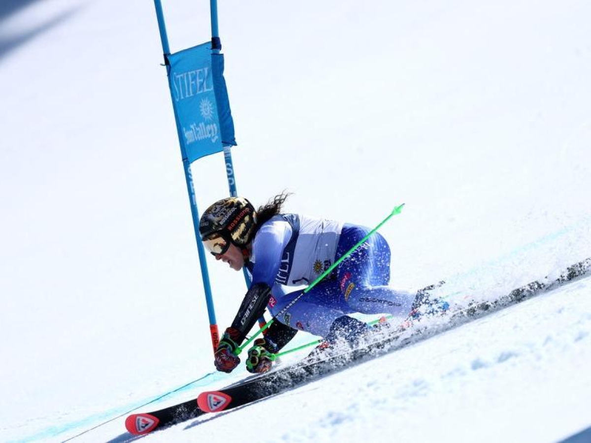 Tibia E Perone Etichettati POLITECNICO DI TORINO