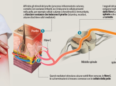 Cause e rimedi contro il prurito: cosa fare se non passa | Corriere.it