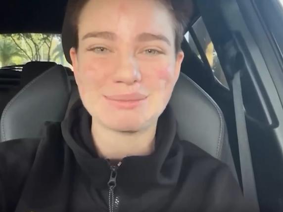 Bebe Vio pronta a tornare alle gare: «Ho subito tre interventi ...