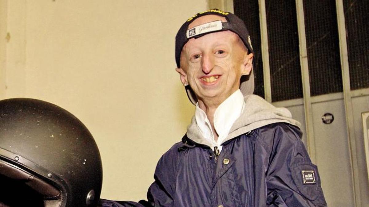 Sammy Basso: la progeria, i viaggi, le lauree e la morte all'improvviso ...