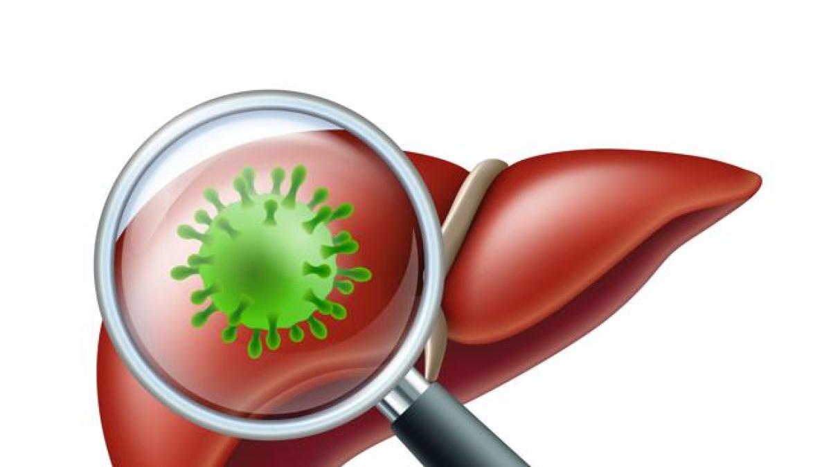 L’epatite Delta, una malattia rara e aggressiva che ora ha una terapia efficace | Corriere.it