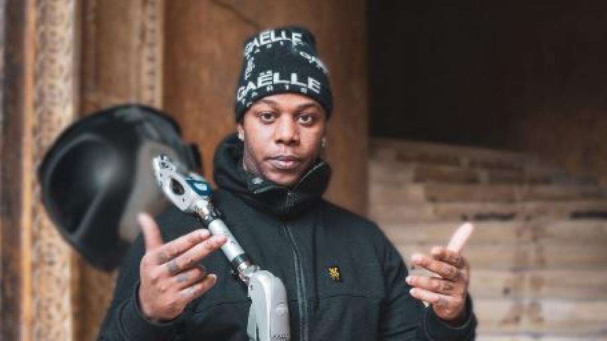 Una nuova protesi per Bubu, il calciatore diventato rapper: «Sono ...