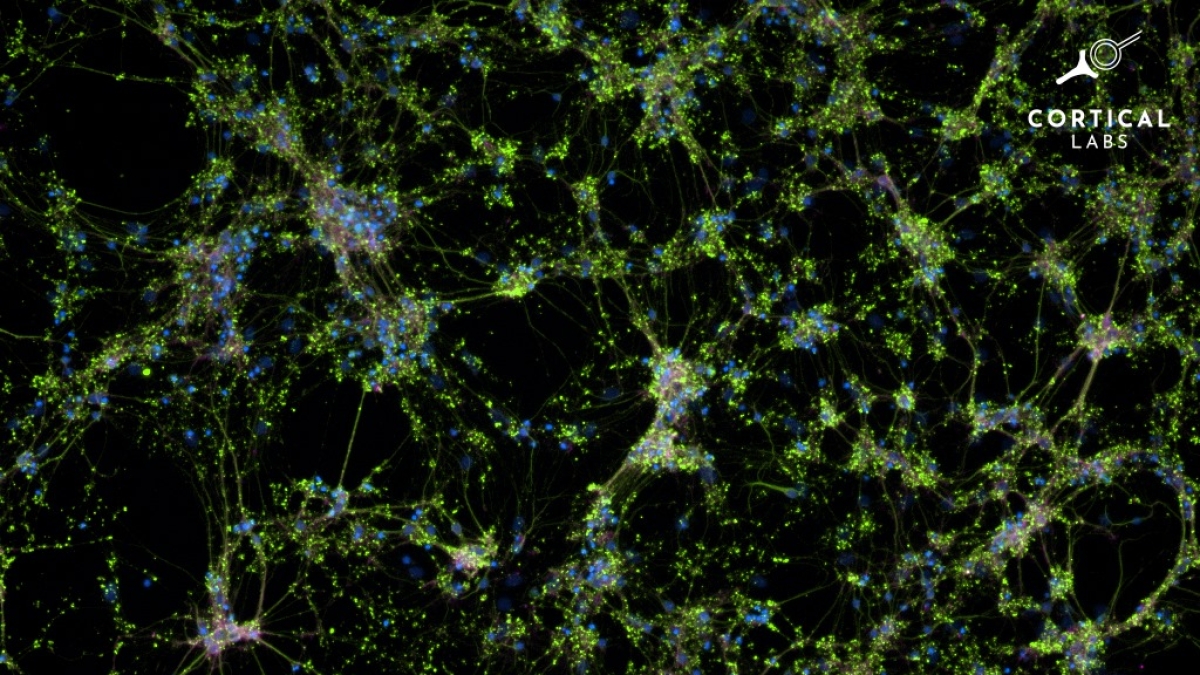 «Il silicio incontra il neurone»: CL1, computer biologico che utilizza ...
