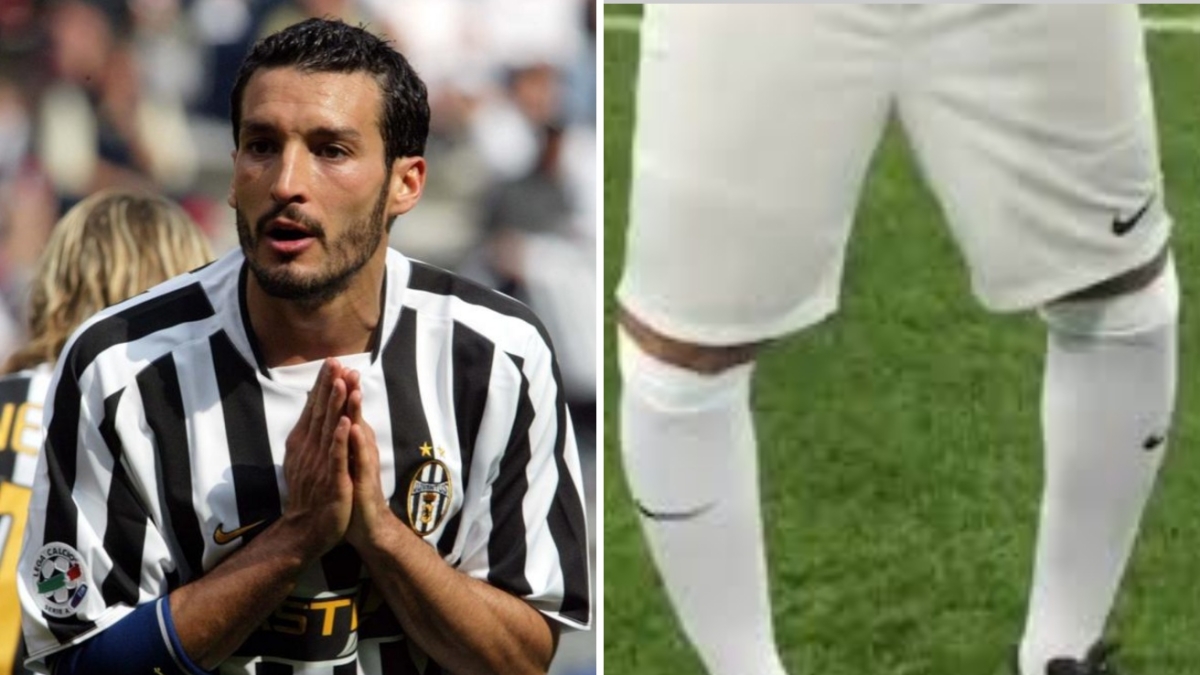 Zambrotta e le gambe curve: «I chirurghi si chiedono come faccia a ...