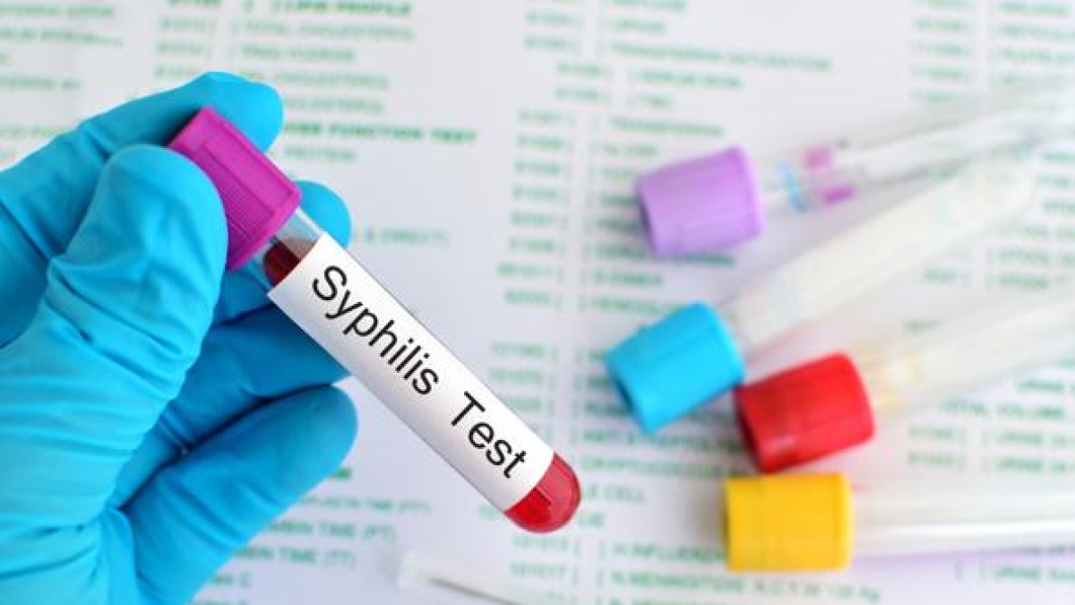 Sifilide, una sola dose di antibiotico cura la forma precoce | Corriere.it