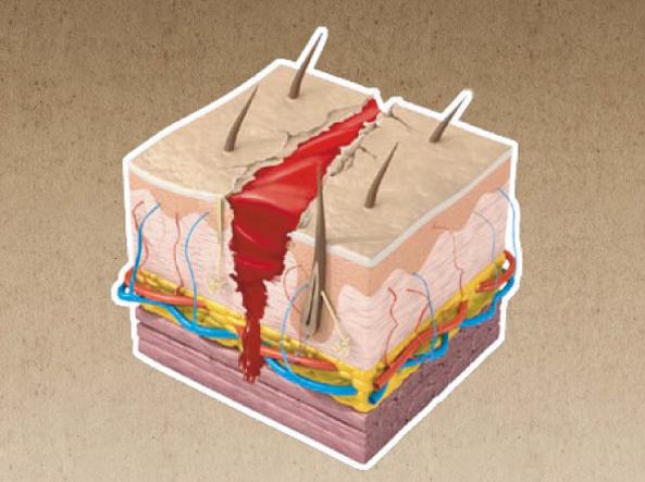 Tagli, ferite e graffi: come affrontare e curare i traumi alla pelle ...