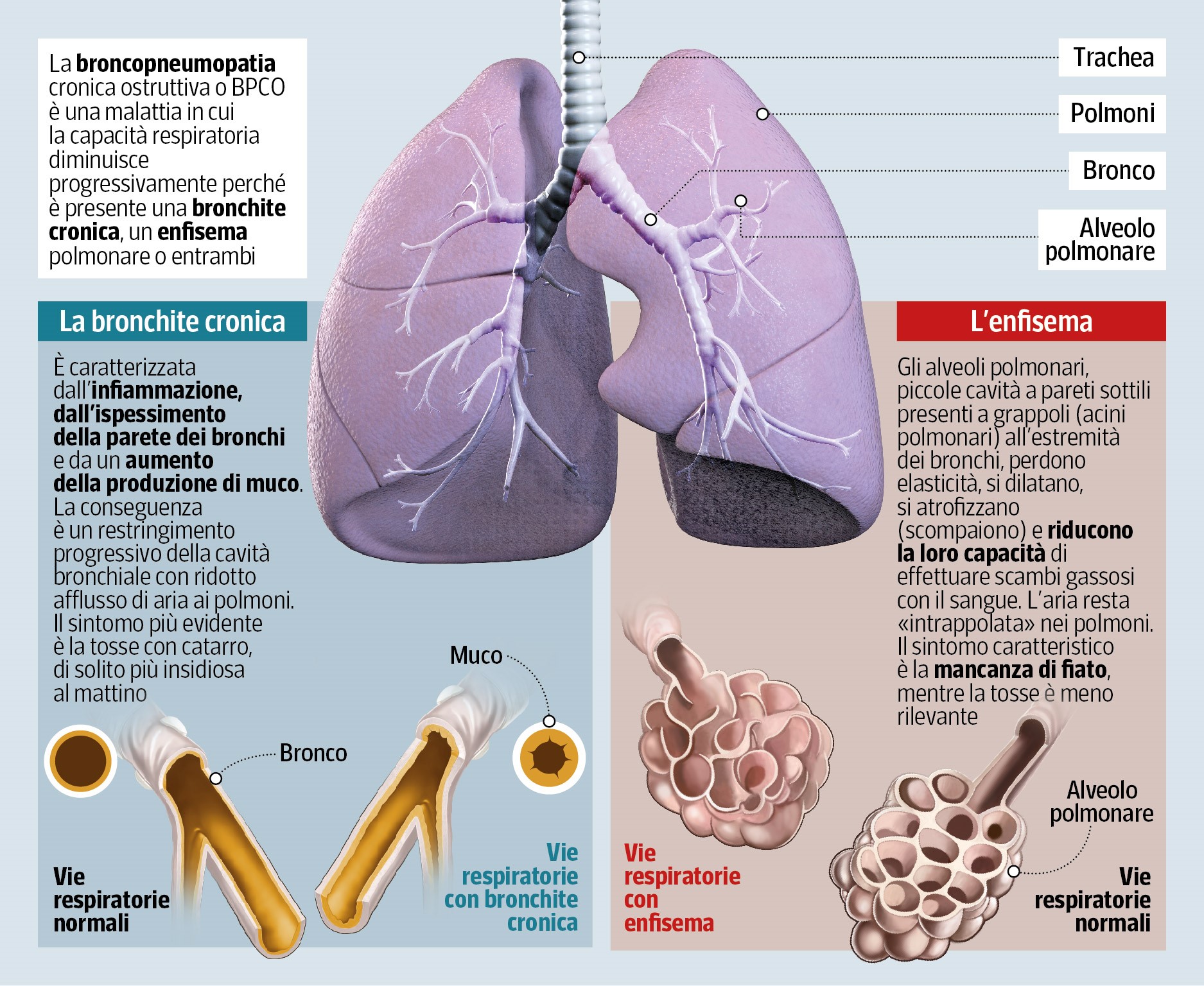 Bronchite cronica ed enfisema: che cos'è la BPCO, come riconoscerla e ...